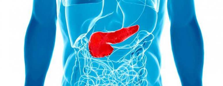 Removing fat from pancreas can reverse type 2 diabetes, study finds