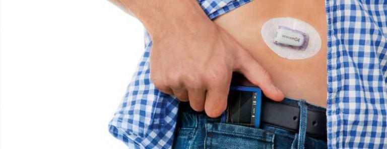 Dexcom CGM users to have clearer way of understanding trend arrows