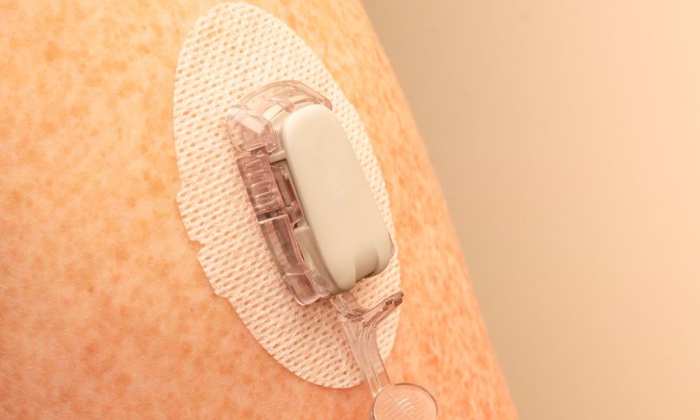 Continuous Glucose Monitoring - What is CGM, Control, How To Get a CGM