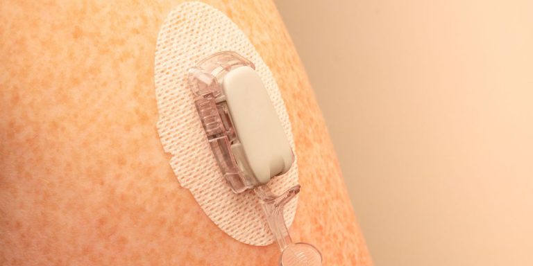 Continuous Glucose Monitoring - What is CGM, Control, How To Get a CGM