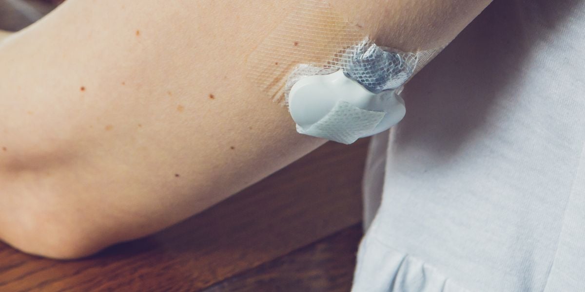 Insulin Patch - How The Insulin Patch Works, Challenges, Research