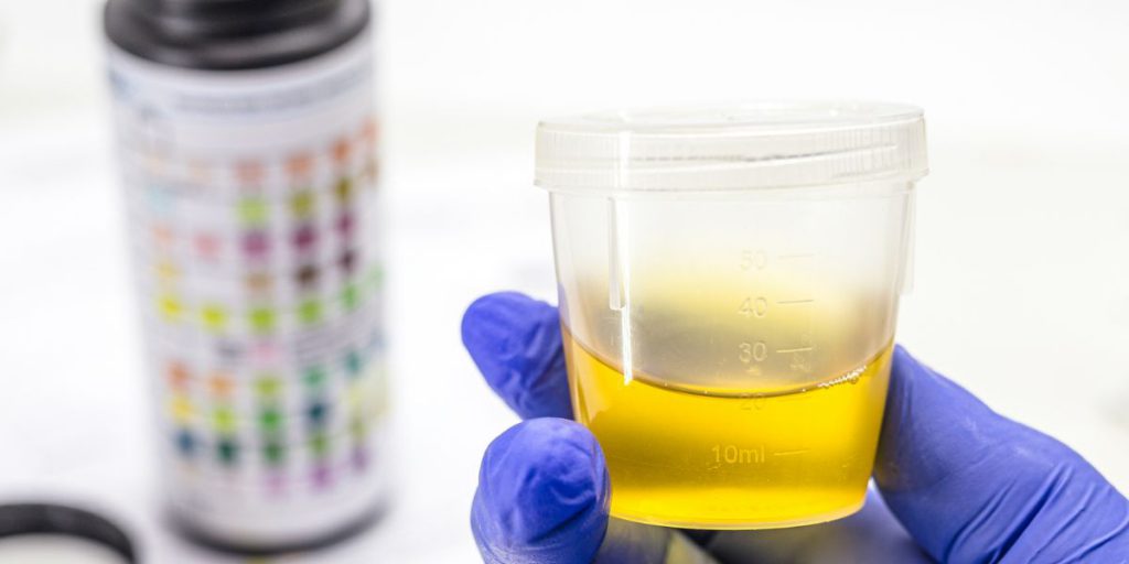 Polyuria - Frequent Urination Symptoms and Causes