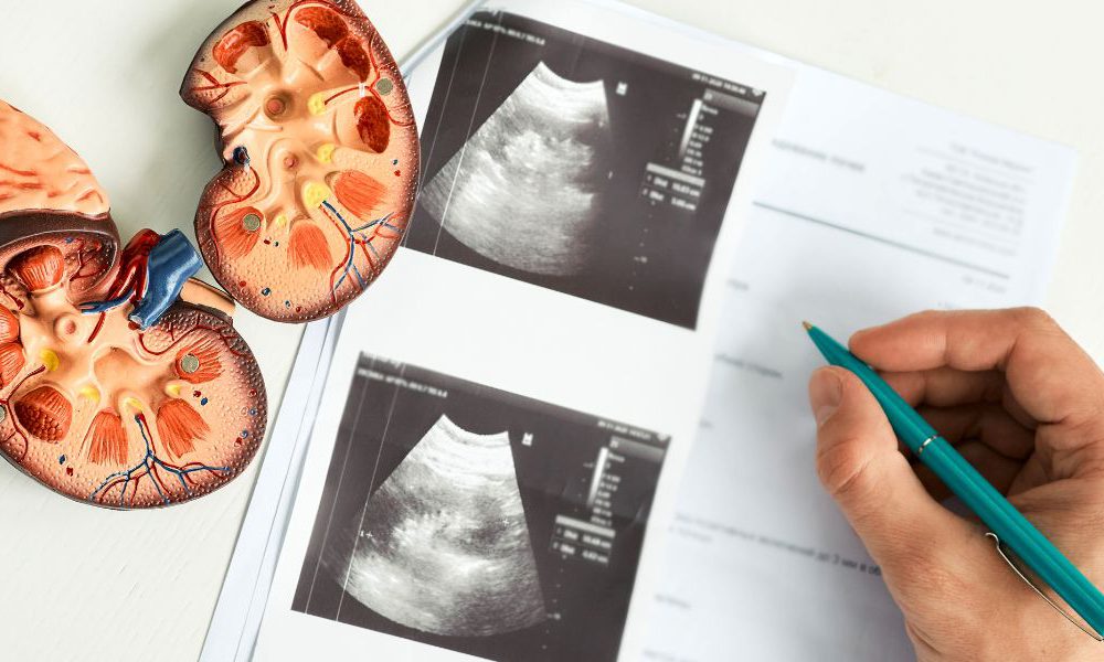 Screening for Kidney Disease - Diabetic Nephropathy Screening