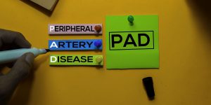 Peripheral Arterial Disease (PAD) - Causes, Symptoms, Treatment