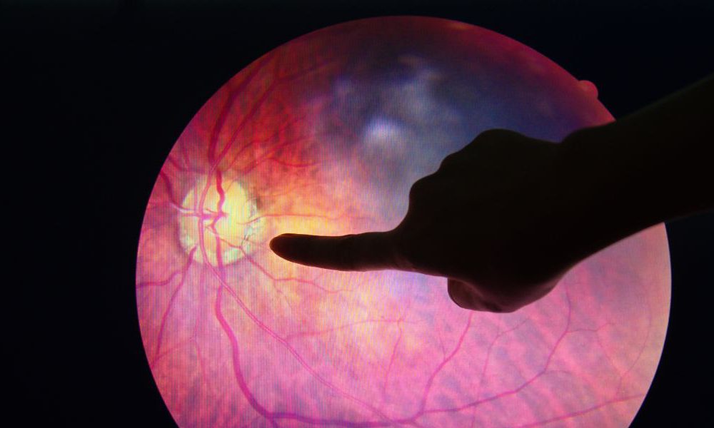 Diabetic Retinopathy Screening and Tests - Eye Checks