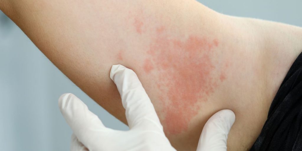 Dr David Cavan: Reversing type 2 diabetes in the real world - Diabetes