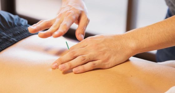 Acupuncture shows promise in improving type 2 diabetes outcomes